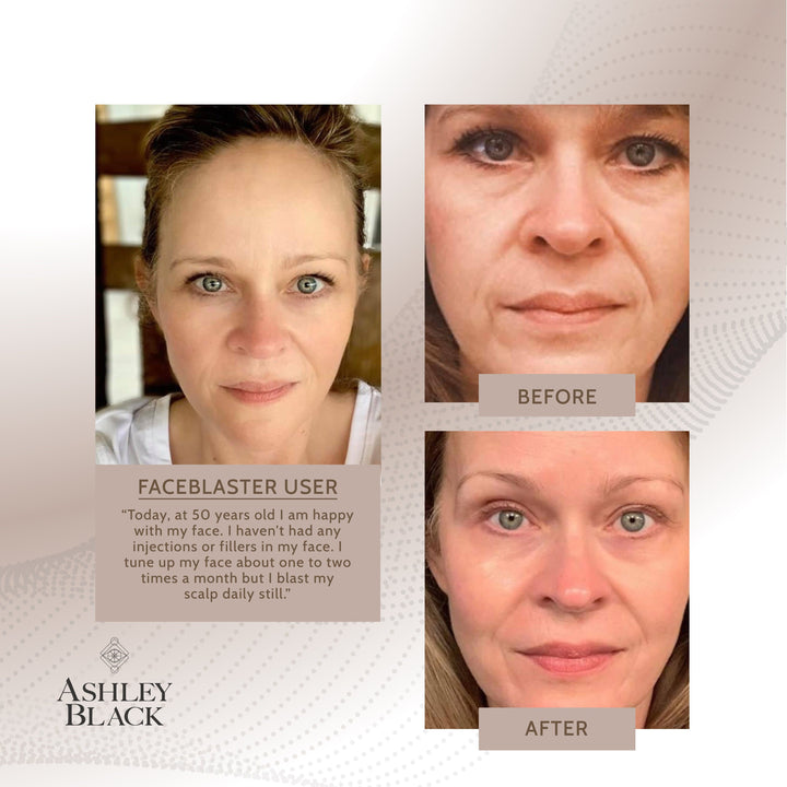 Face Fascia Massage Tool | Ashley Black