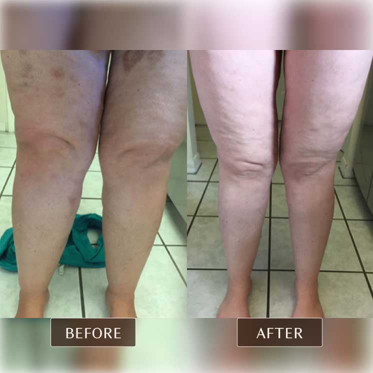 Gorgeous Legs Challenge Part 1