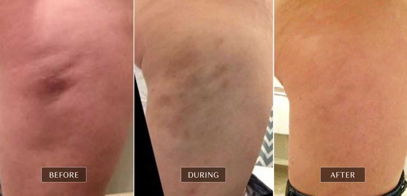 Gorgeous Legs Challenge Part 1