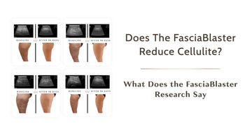 6 Myths About FasciaBlaster Damage & Bruising | Ashley Black