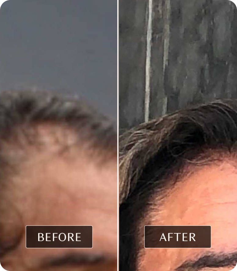 Hair Growth Before & After Results | Ashley Black