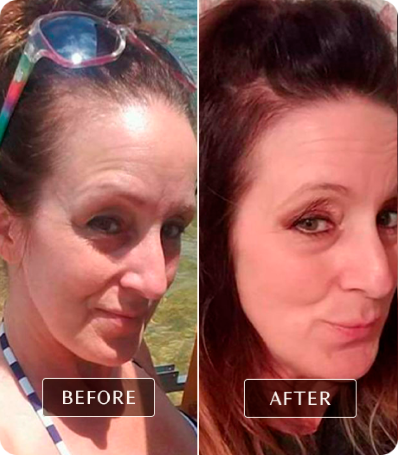 Hair Growth Before & After Results | Ashley Black