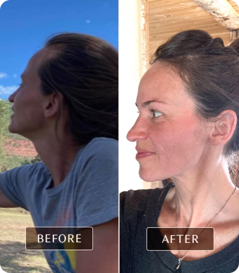Hair Growth Before & After Results | Ashley Black