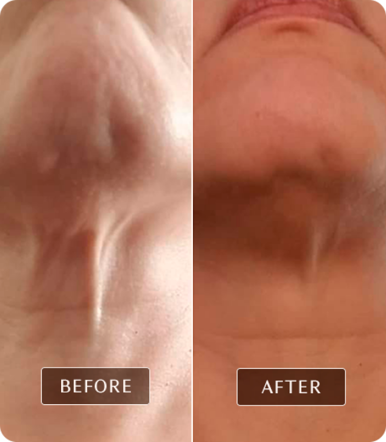 Jaw & Neck Before and After Results | Ashley Black