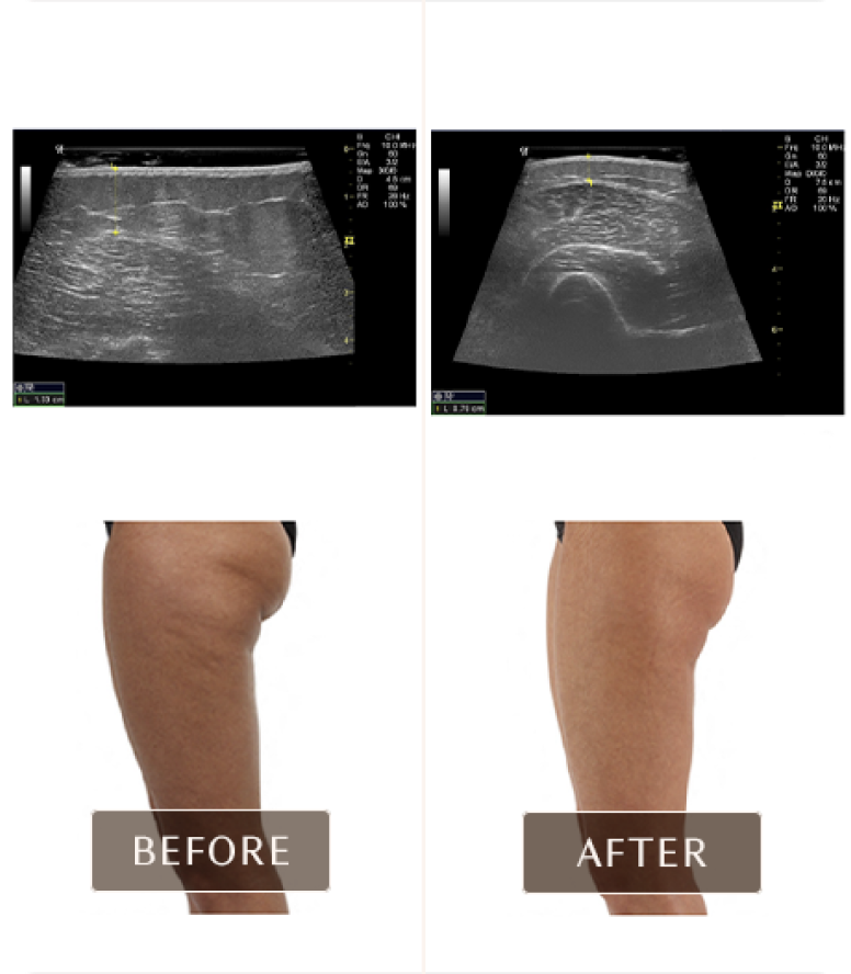 Gallery - From our study