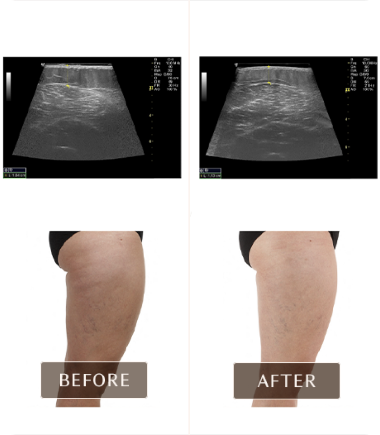 Gallery - From our study