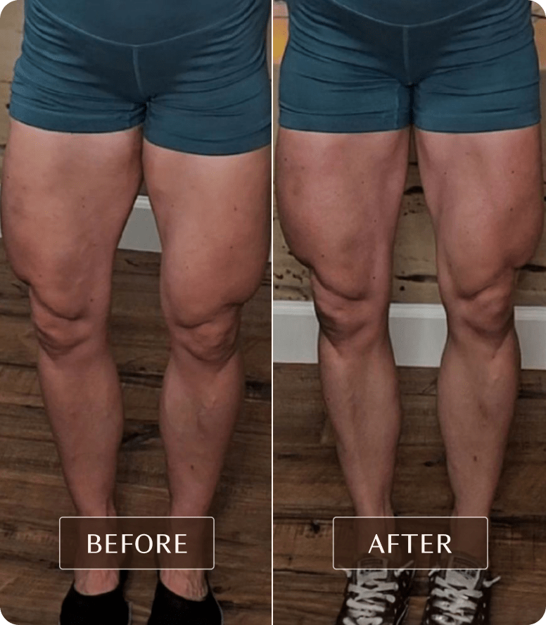 Gallery - Muscle Definition