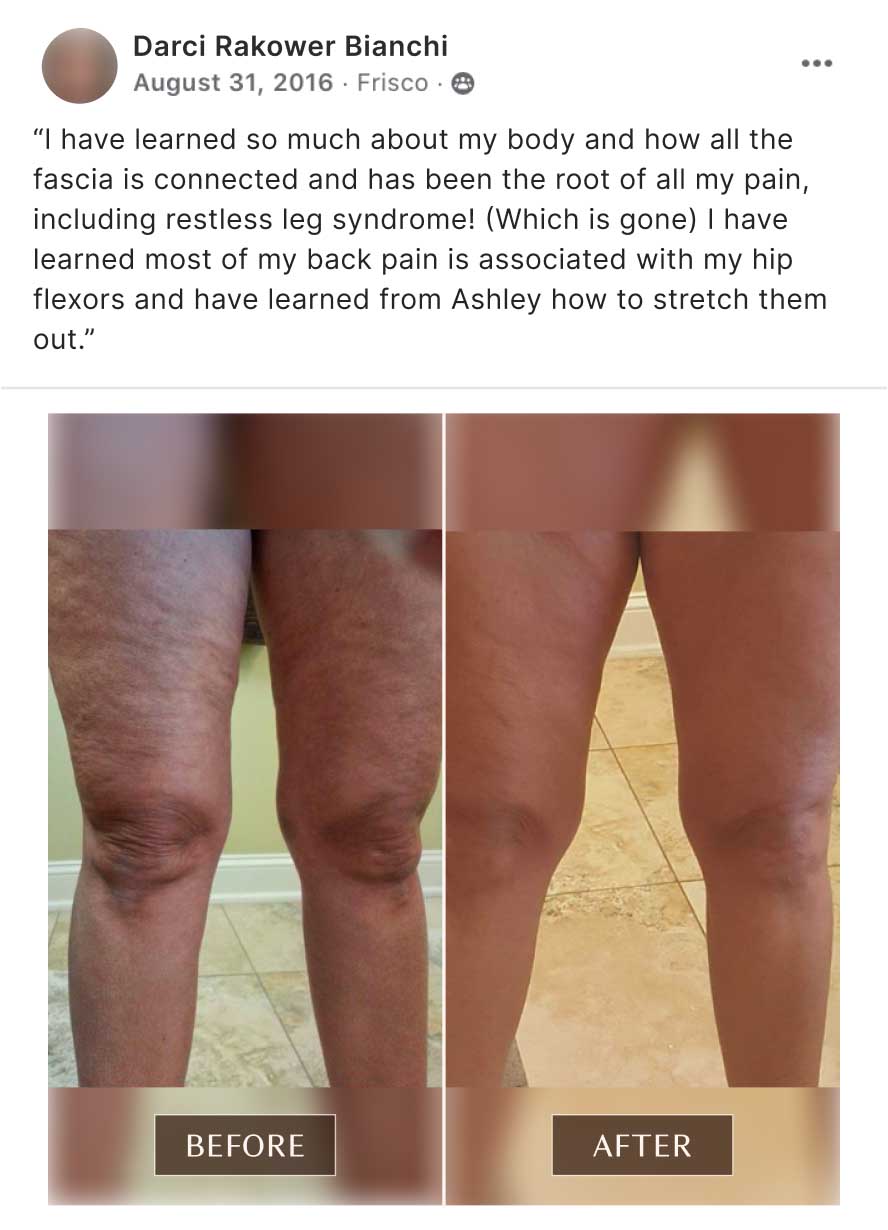 Fascia & Pain Relief: Everything You Need to Know