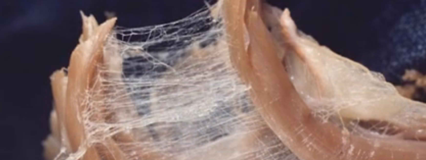 The Role of Fascia in Mental Wellness: Stress and Self-Care